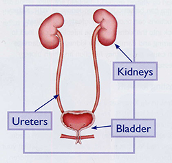 Bladder Outlet Obstruction | St. Louis Children's Hospital