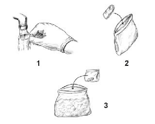 First Aid - Amputated Finger or Toe - Transport | St. Louis Children's ...
